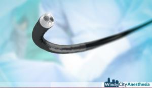 IV Sedation for In-Office Cystoscopy